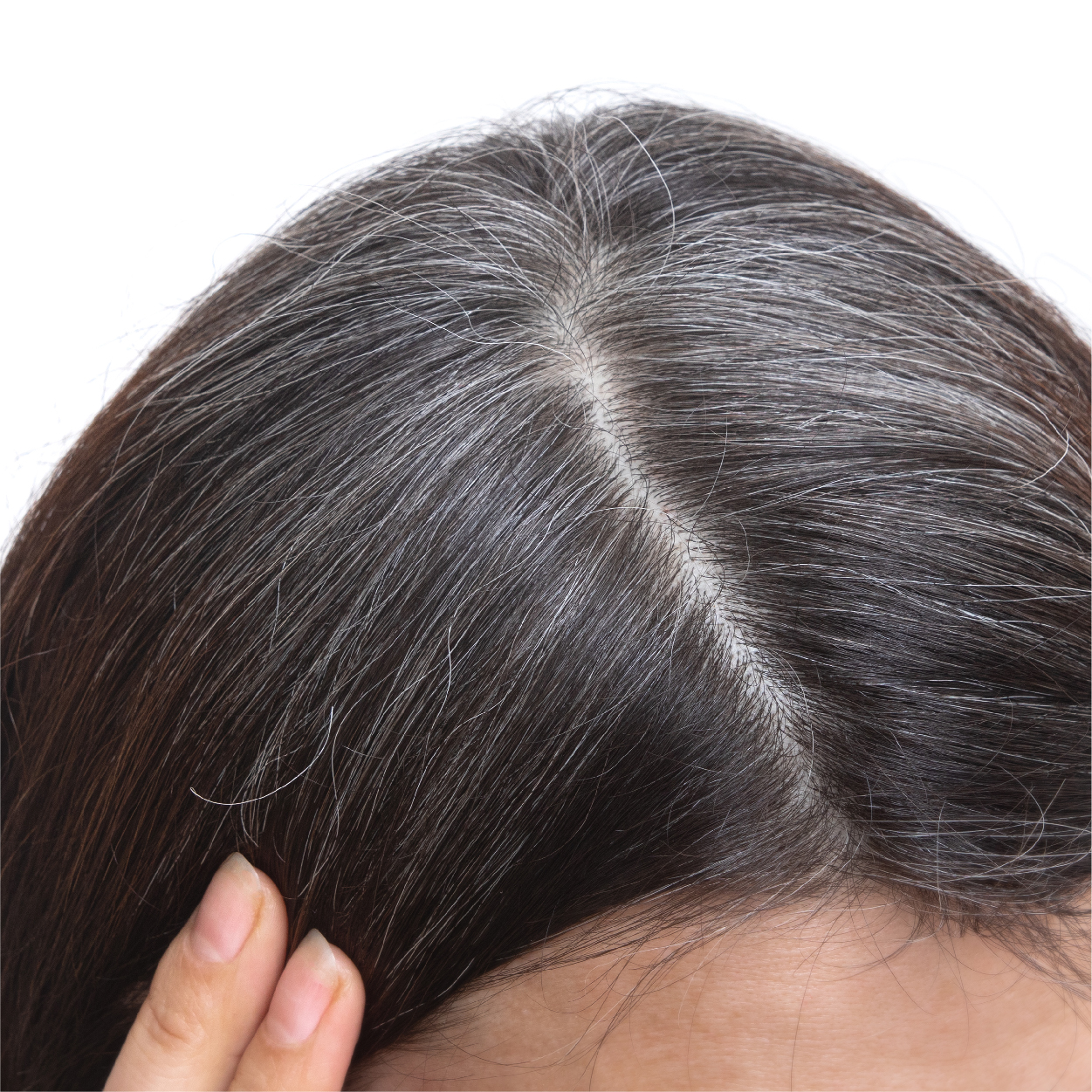 What is Your Biggest Hair Concern? - VitaHealth Malaysia